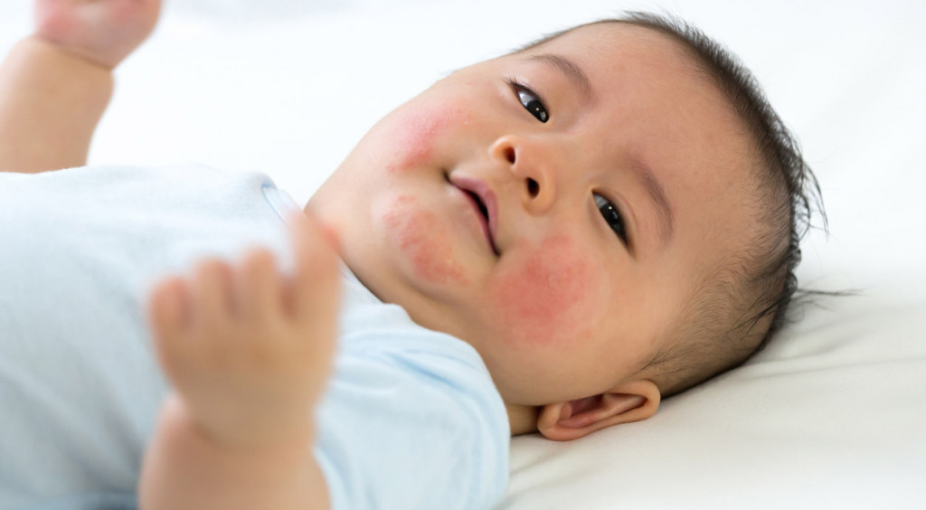 Tanda-tanda Penyakit Autoimun pada Anak yang Harus Diperhatikan ...