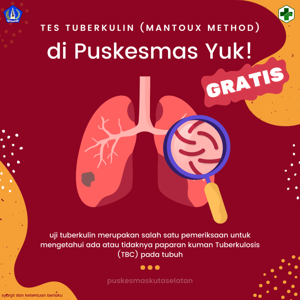 Layanan Tes Tuberkulin (TBC) | Puskesmaskutaselatan Badung